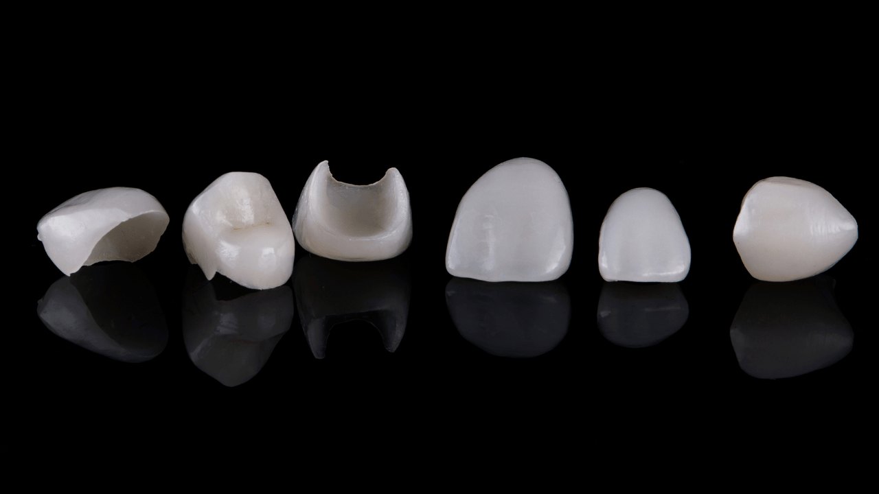 Veneers in Korea | Best Dental Clinics, What To Expect & Prices